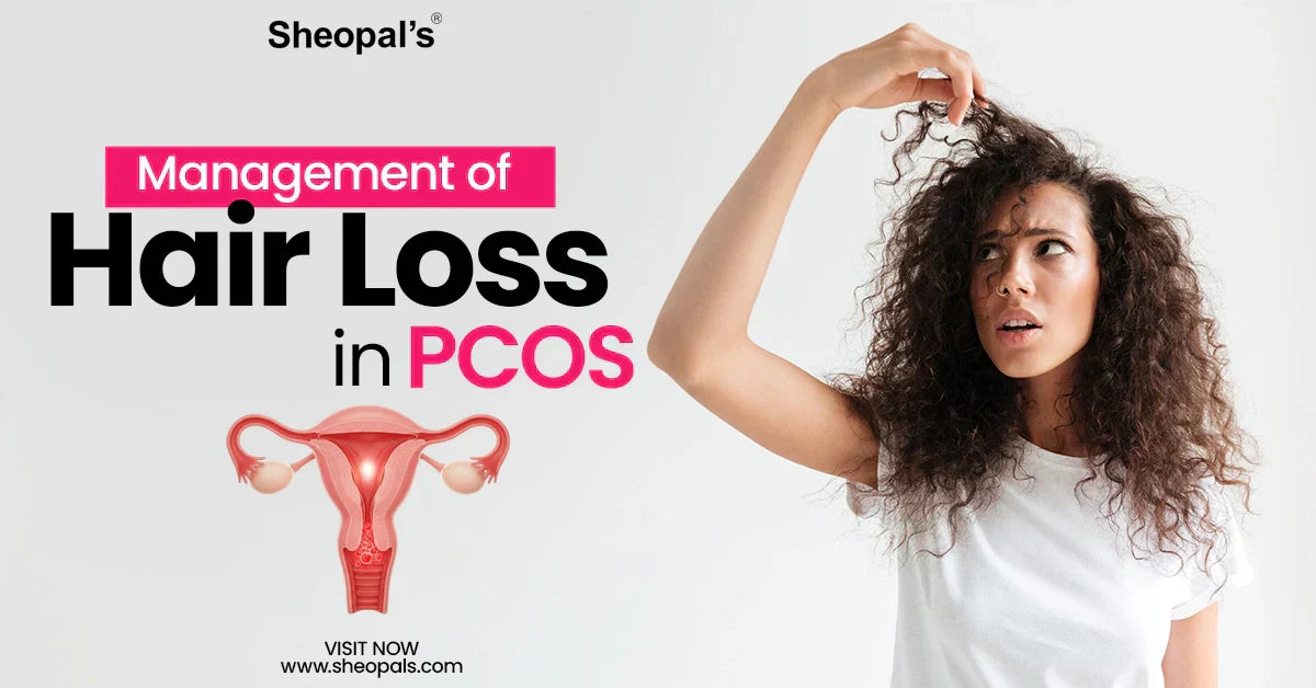 Management of Hair Loss in PCOS (Polycystic Ovary Syndrome) – Sheopals