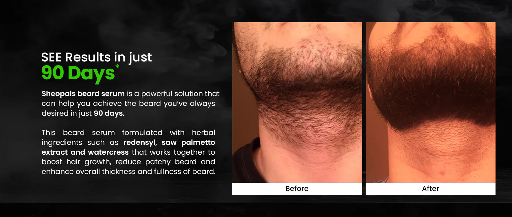 Sheopals Beard Serum With Redensyl | Beard Hair Growth Serum